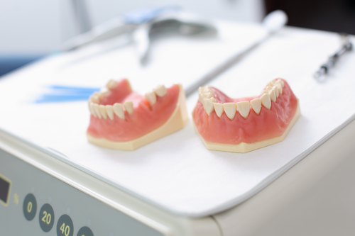 Amazing Dentures in Silver Spring & Hyattsville, MD | Stellar Dental