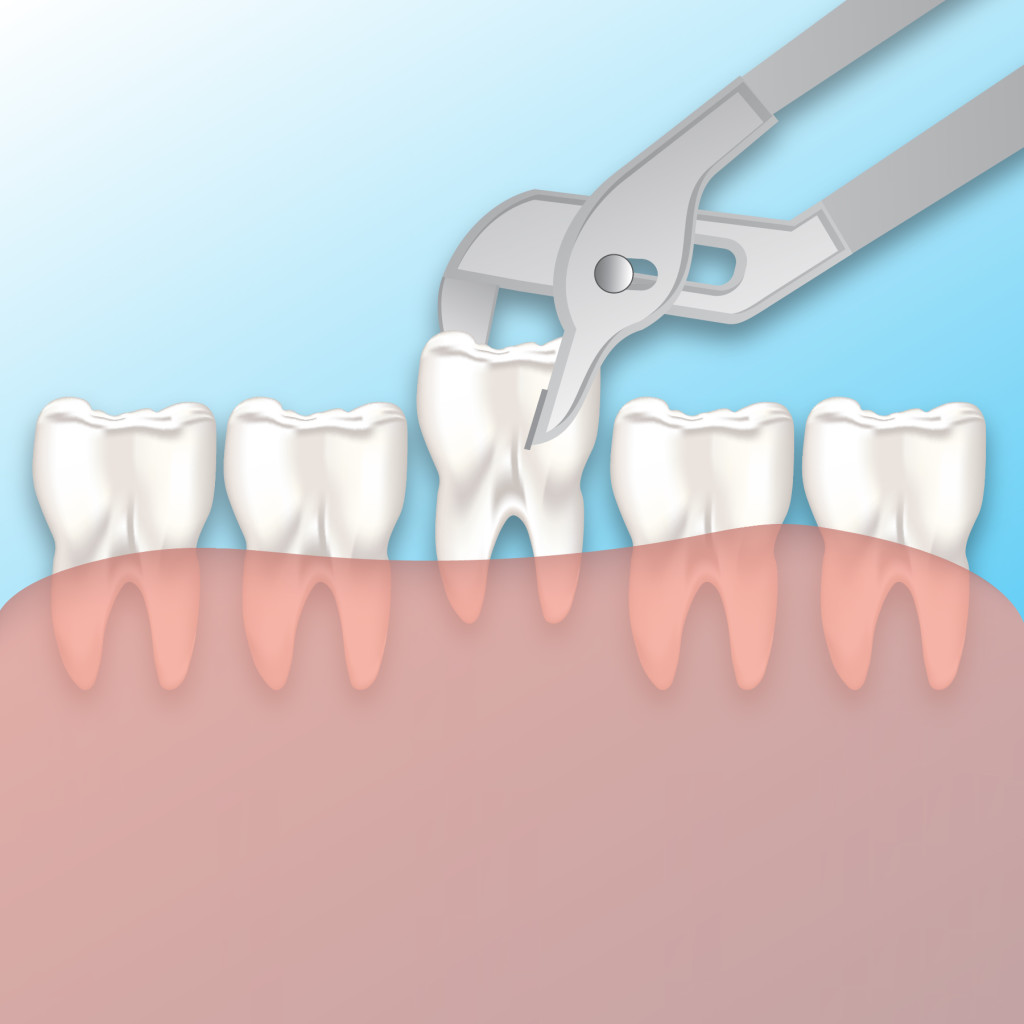 Post-Op Instructions | Stellar Dental: Dentist in Hyattsville & Silver ...